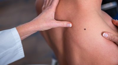 Cisti benigne o maligne? Come riconoscerle